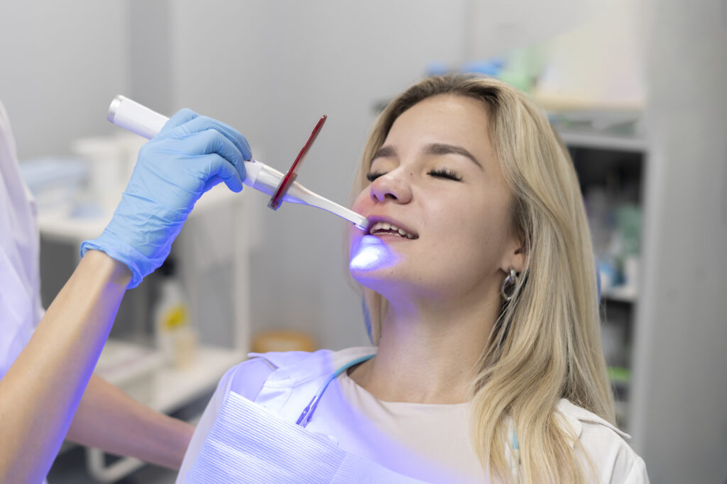 The Benefits of Choosing Professional Teeth Whitening Services